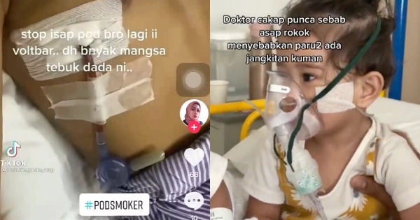 Ramai Yang Jadi Mangsa Sebab Rokok Dan Vape, NGO Gesa Tindakan Keras ...